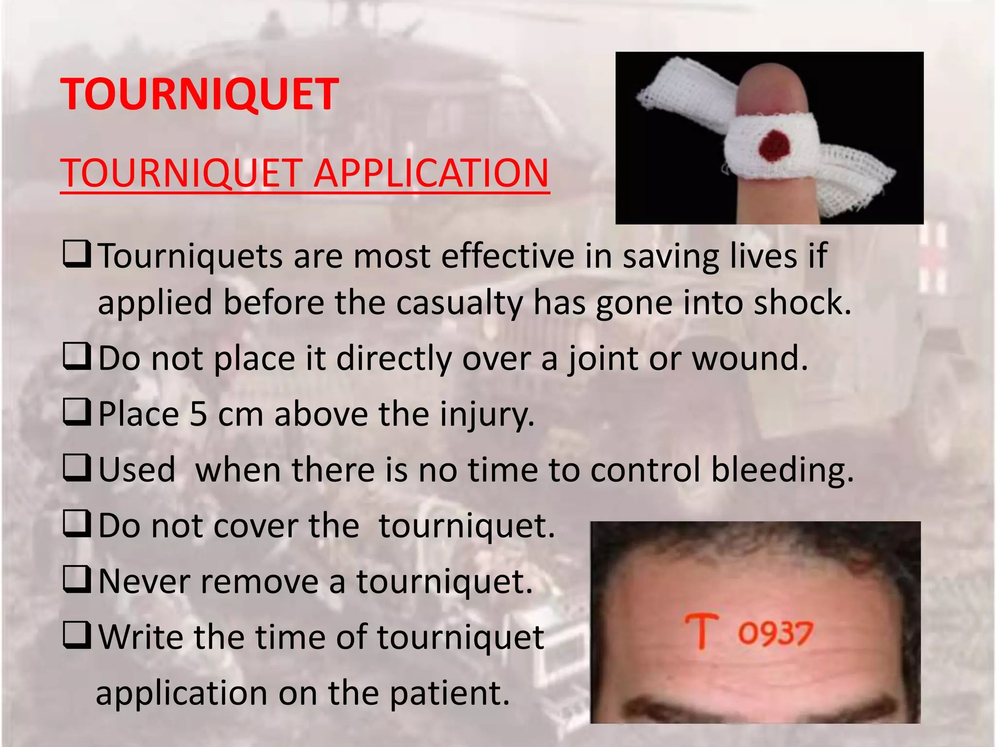 Haemorrhage control in combat | PPTX