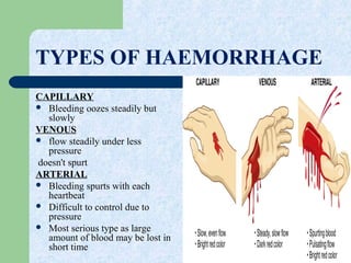 Haemorrhage (original) | PPT