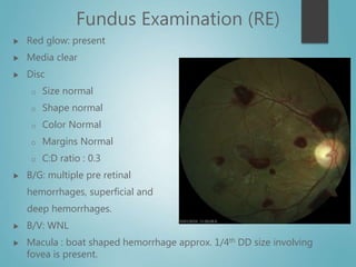 Haemorrhagic retinopathy with hemolytic anaemia | PPTX