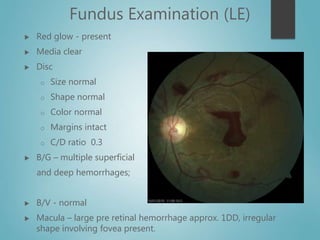 Haemorrhagic retinopathy with hemolytic anaemia | PPTX