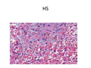 Haemorrhagic_Septicemia in Ruminant ,Gal ghotus | PPTX