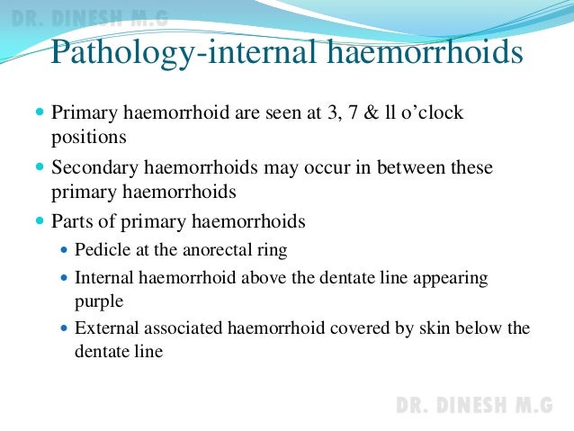 Haemorrhoids