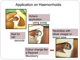 Haemorrhoids and its Management: How can Ayurveda have the upper hand ...