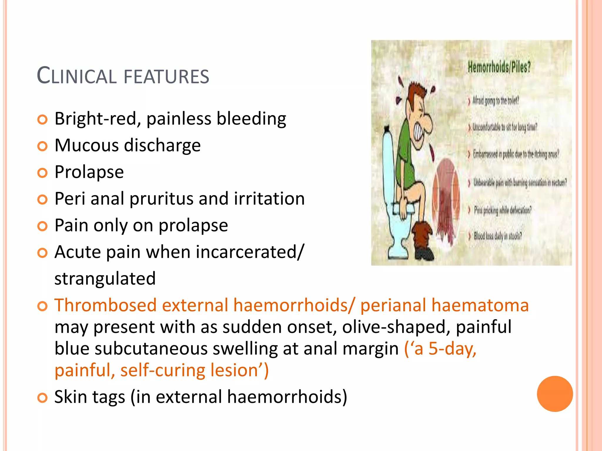 Haemorrhoids | PPTX