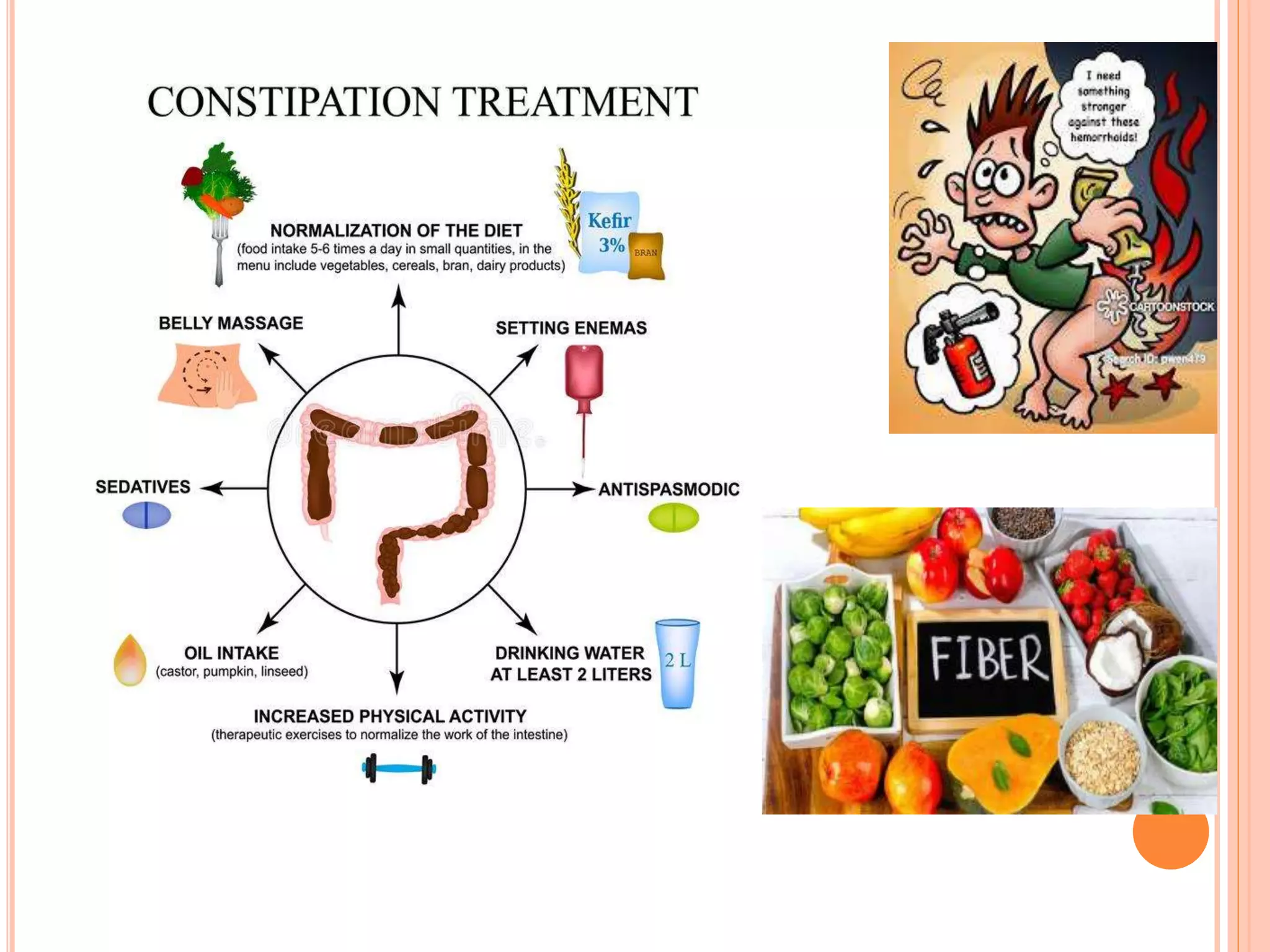Haemorrhoids | PPTX