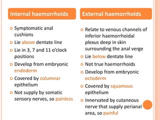 Haemorrhoids | PPTX