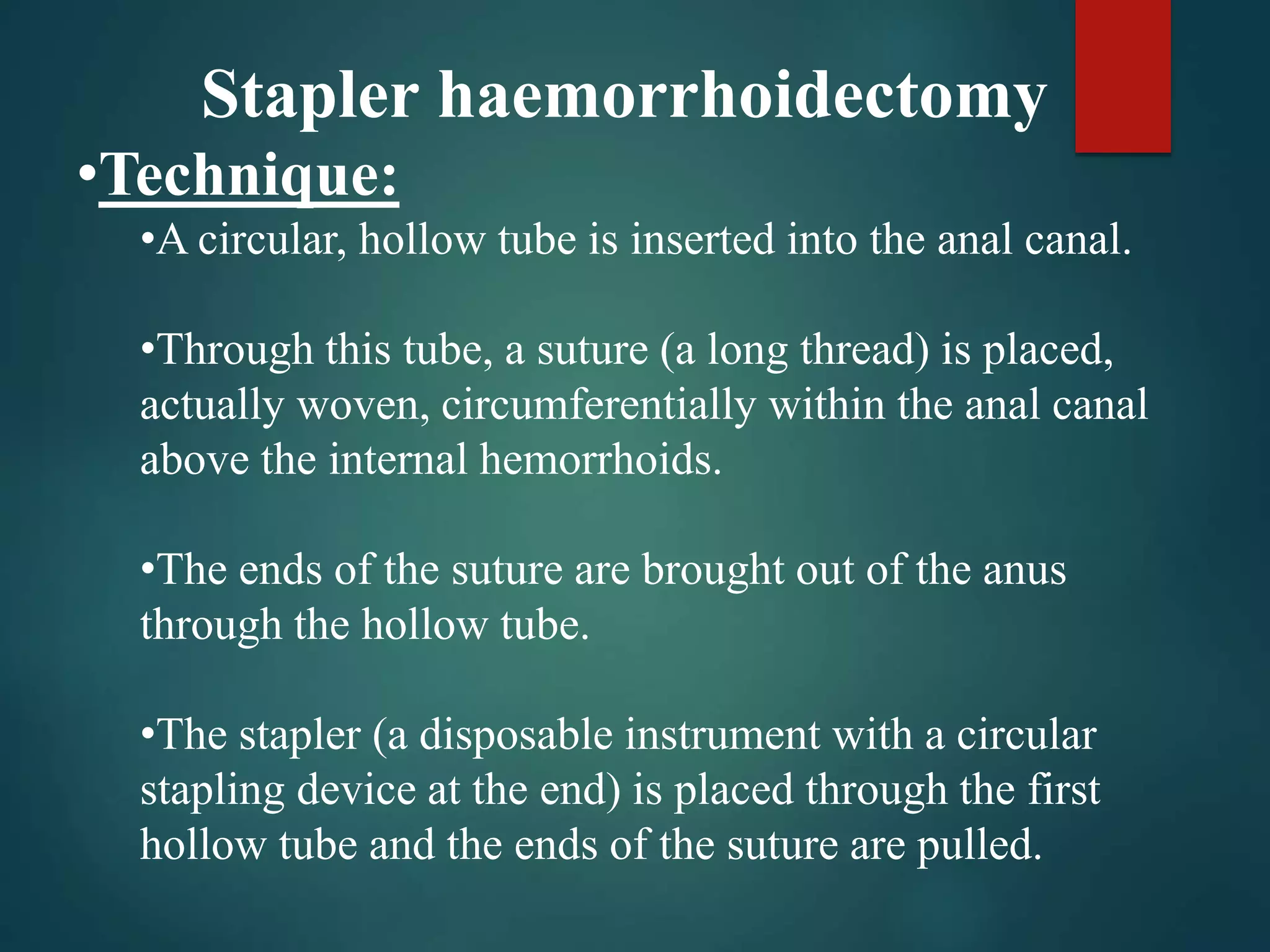 HAEMORRHOIDS Management.pptx