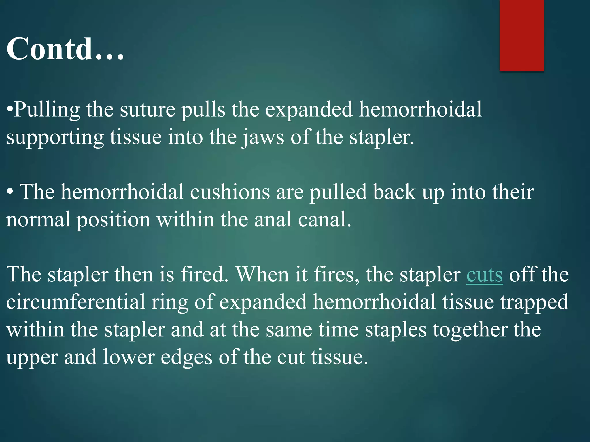 HAEMORRHOIDS Management.pptx