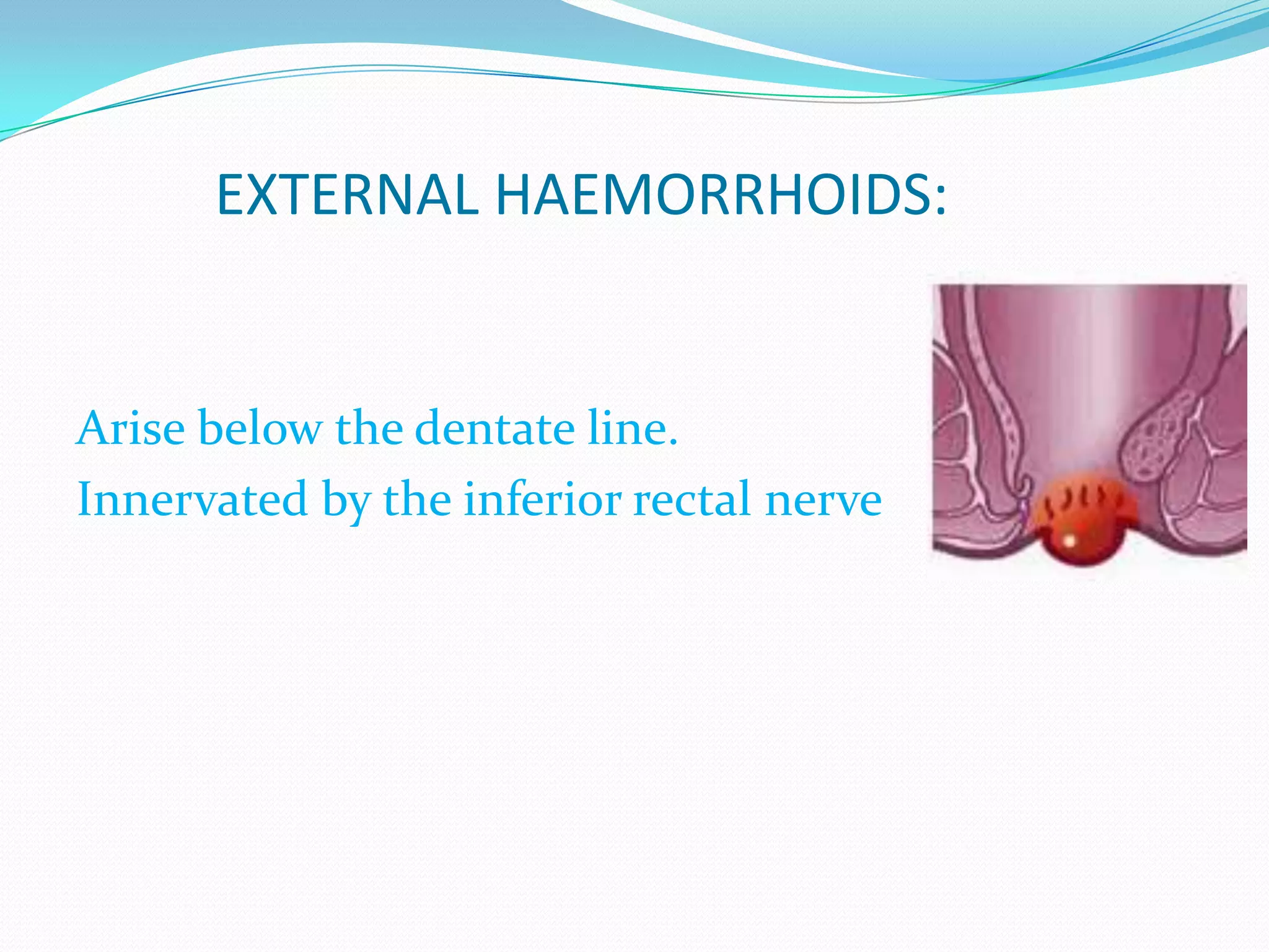 Haemorrhoids (piles) | PPTX