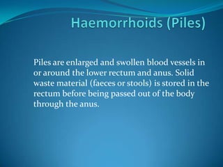 Haemorrhoids (piles) | PPT