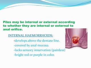 Haemorrhoids (piles) | PPT