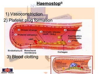 Haemostop dental | PPT