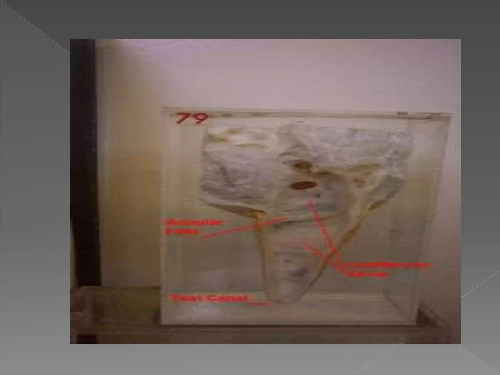 Mammary system, Milk Synthesis, Milk Let-down & Milking | PPTX