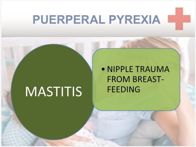 Puerperal Pyrexia | PPT | Pregnancy | Reproductive Health