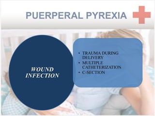 Puerperal Pyrexia | PPT