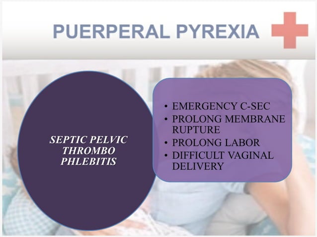 Puerperal Pyrexia | PPT | Pregnancy | Reproductive Health