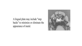 Mandibular major connector(removable partial denture ) | PPTX