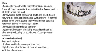 Mandibular major connector(removable partial denture ) | PPTX