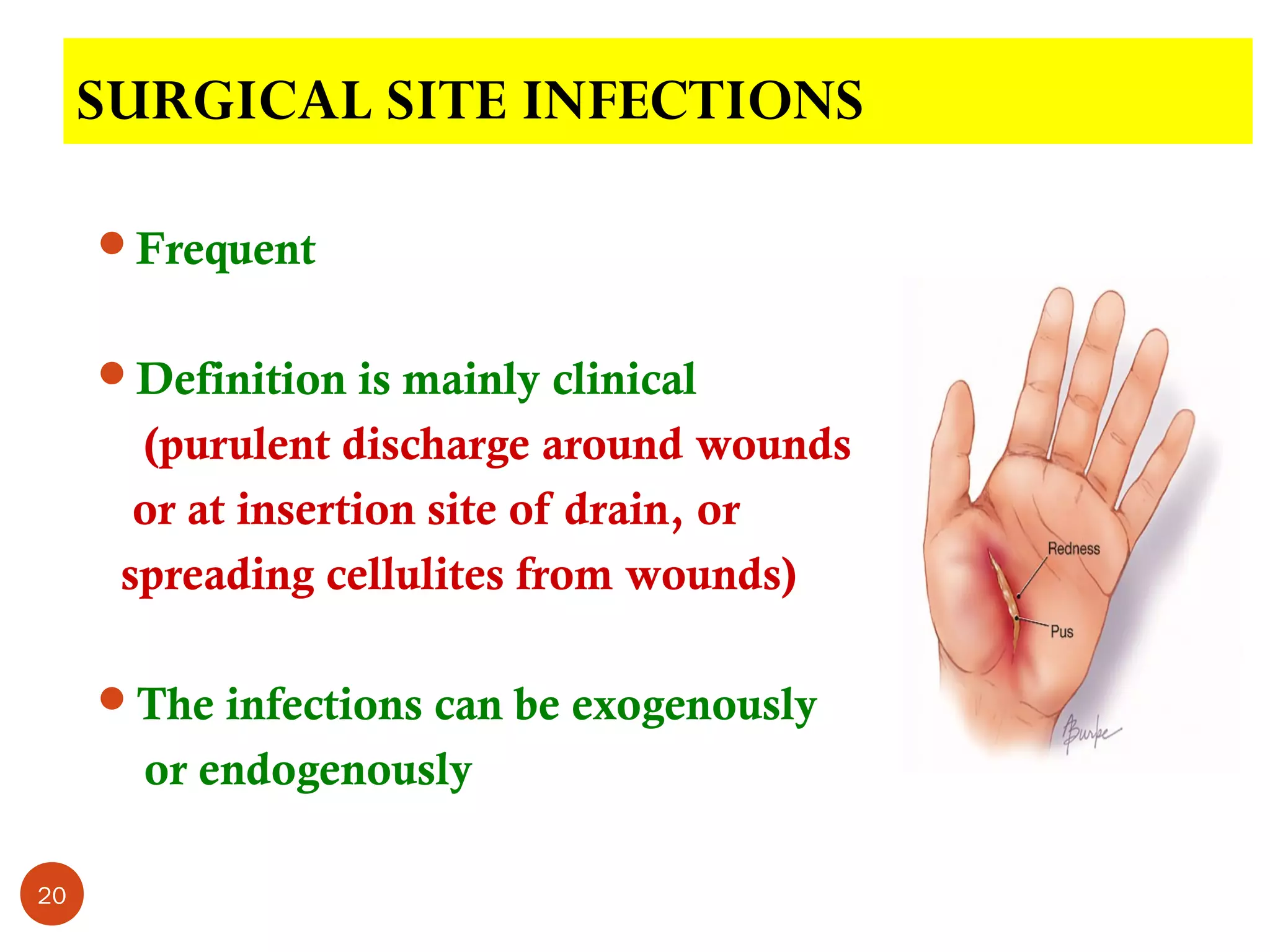 HEALTH CARE ASSOCIATED INFECTION | PPT