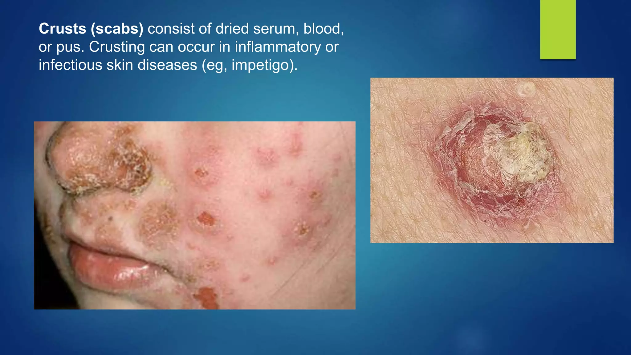 HEALTH ASSESSMENT intro to PHYSICAL ASSESSMENT and IPPA 2021 | PPTX