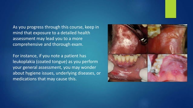 HEALTH ASSESSMENT intro to PHYSICAL ASSESSMENT and IPPA 2021 | PPTX
