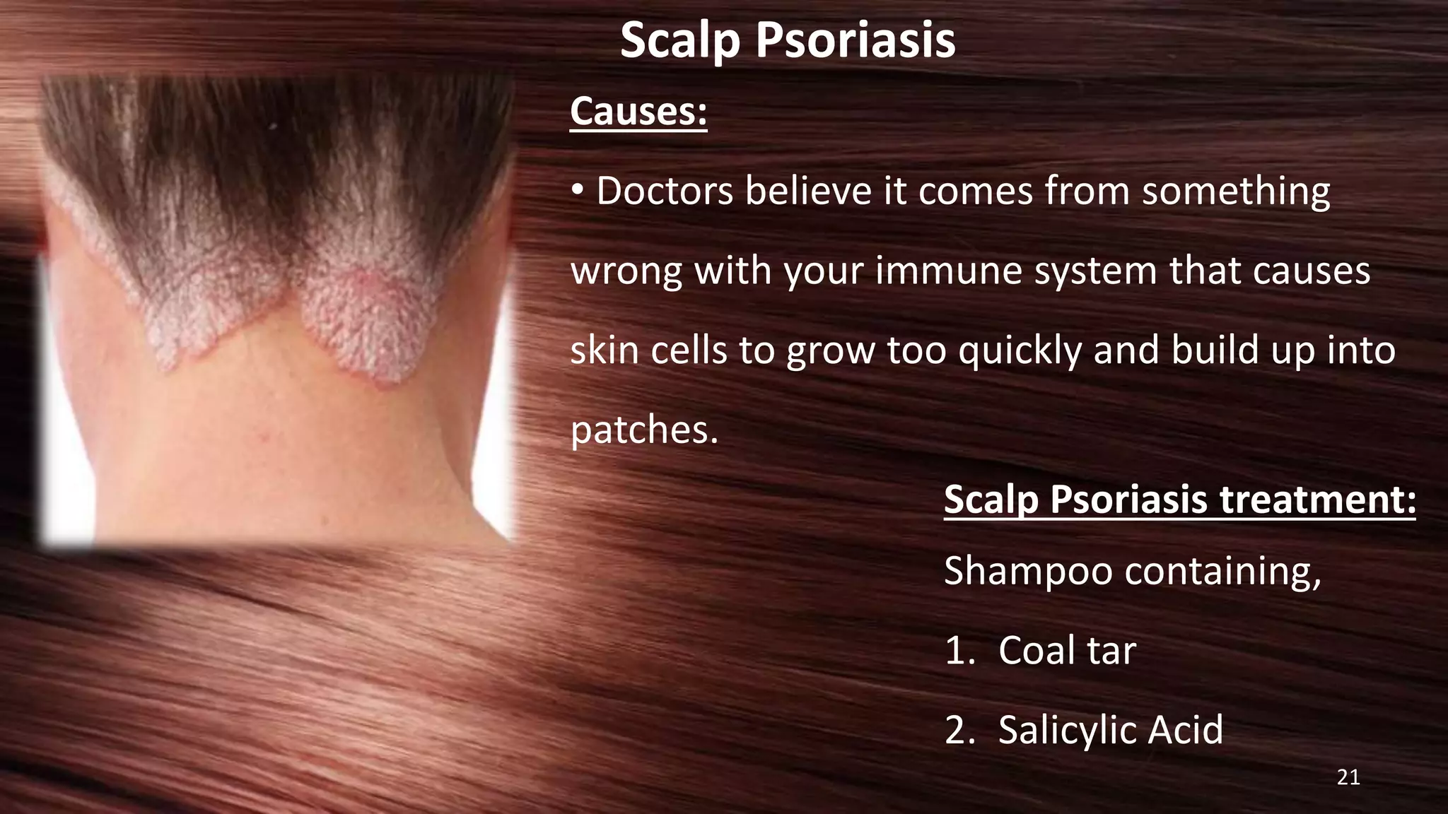 Hair | PPSX | Skin and Dermatology | Diseases and Conditions