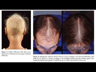 Hair standards | PPT