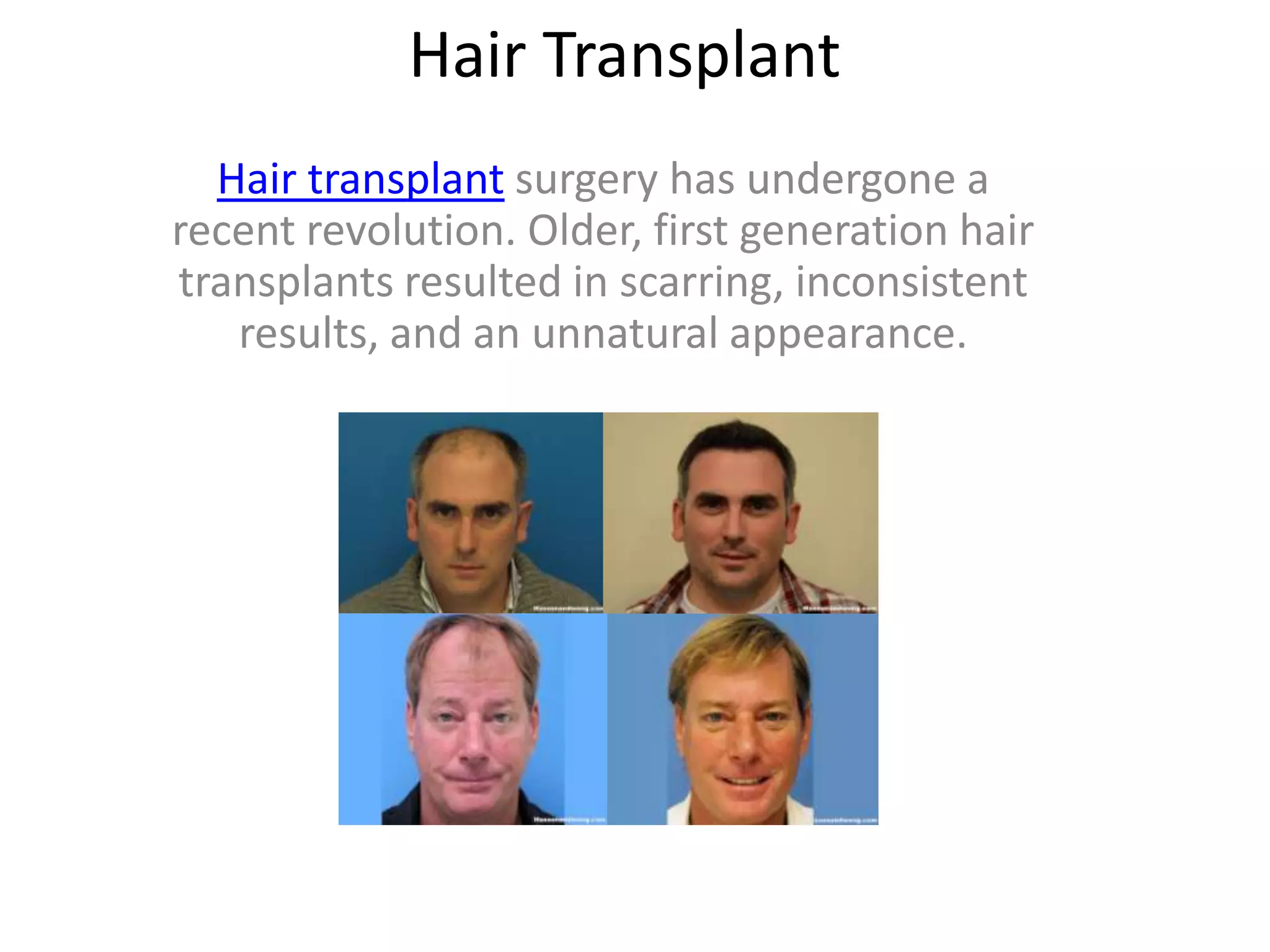 Hair transplant | PPT
