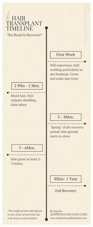 Hair Transplant Timeline [Infographics]: The Road to Recovery | PDF
