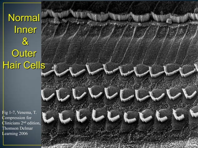 Hair cell function and purpose | PPTX | Ear, Nose and Throat Conditions ...