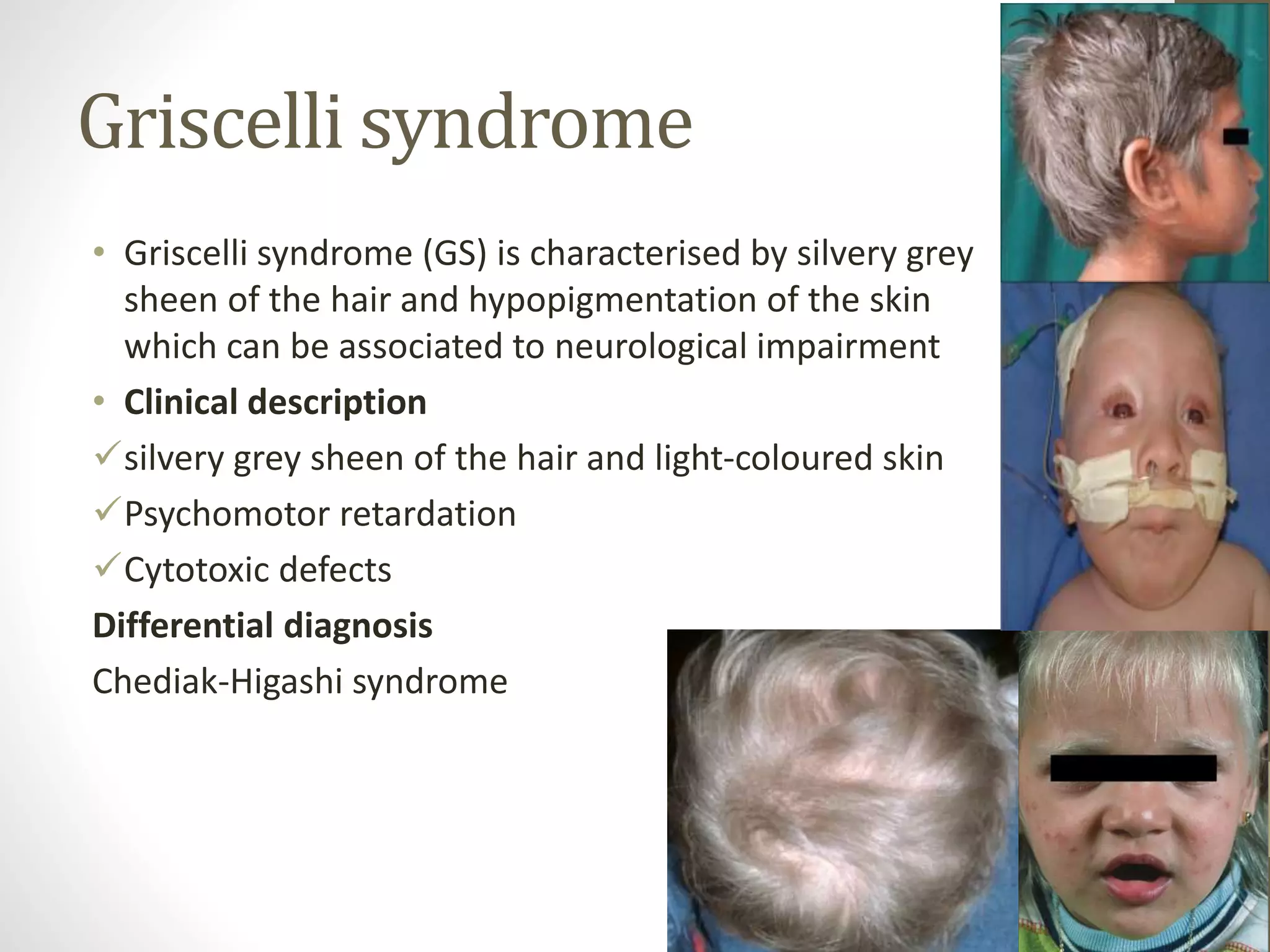 Hair defects and differential diagnosis | PPTX