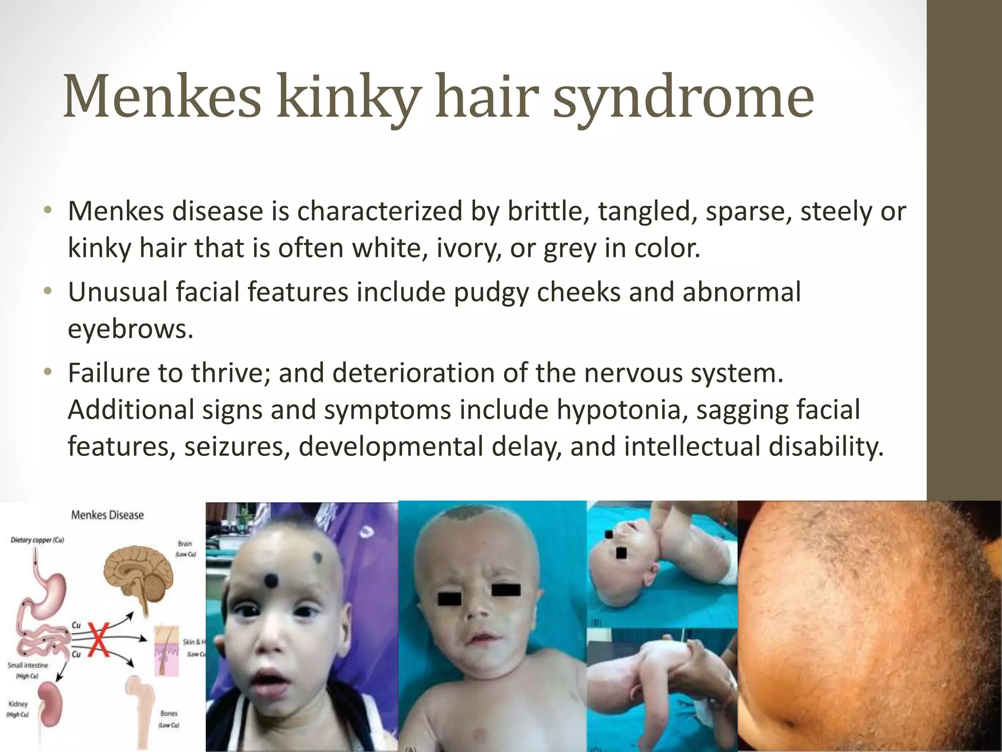 Hair defects and differential diagnosis | PPTX