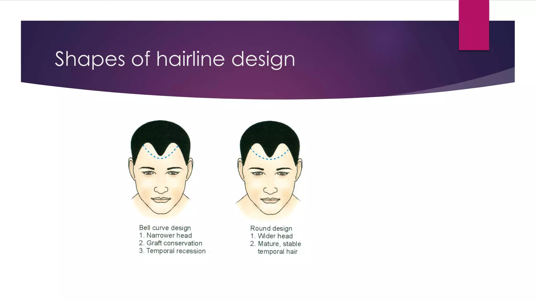 HAIRLINE DESIGNING - Chennai Plastic Surgery | PPTX