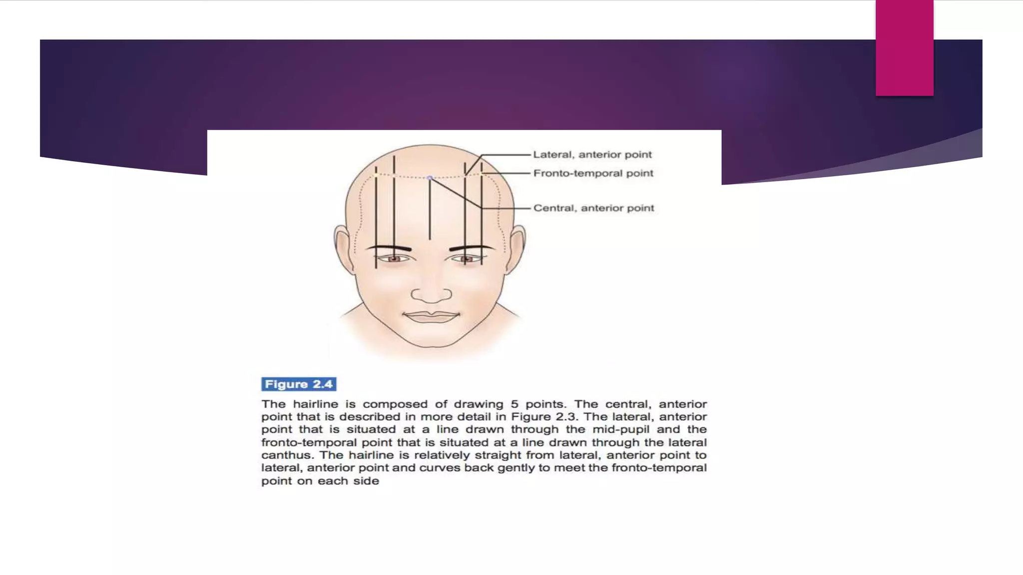 HAIRLINE DESIGNING - Chennai Plastic Surgery | PPT