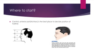 HAIRLINE DESIGNING - Chennai Plastic Surgery | PPT