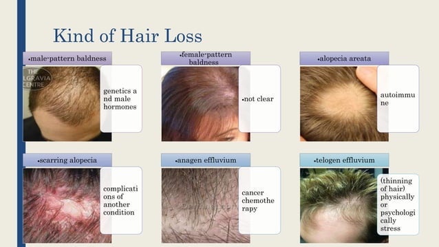 Hair fall: Cause & Solution | PPTX