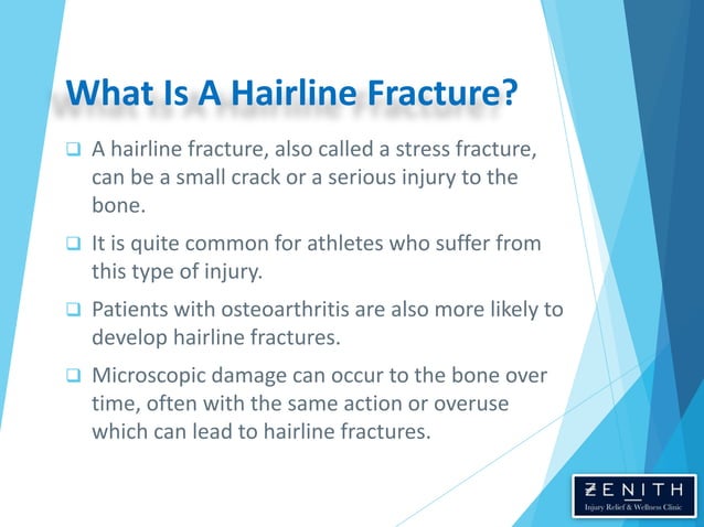 Hairline Fracture - Causes, Symptoms and Treatment.