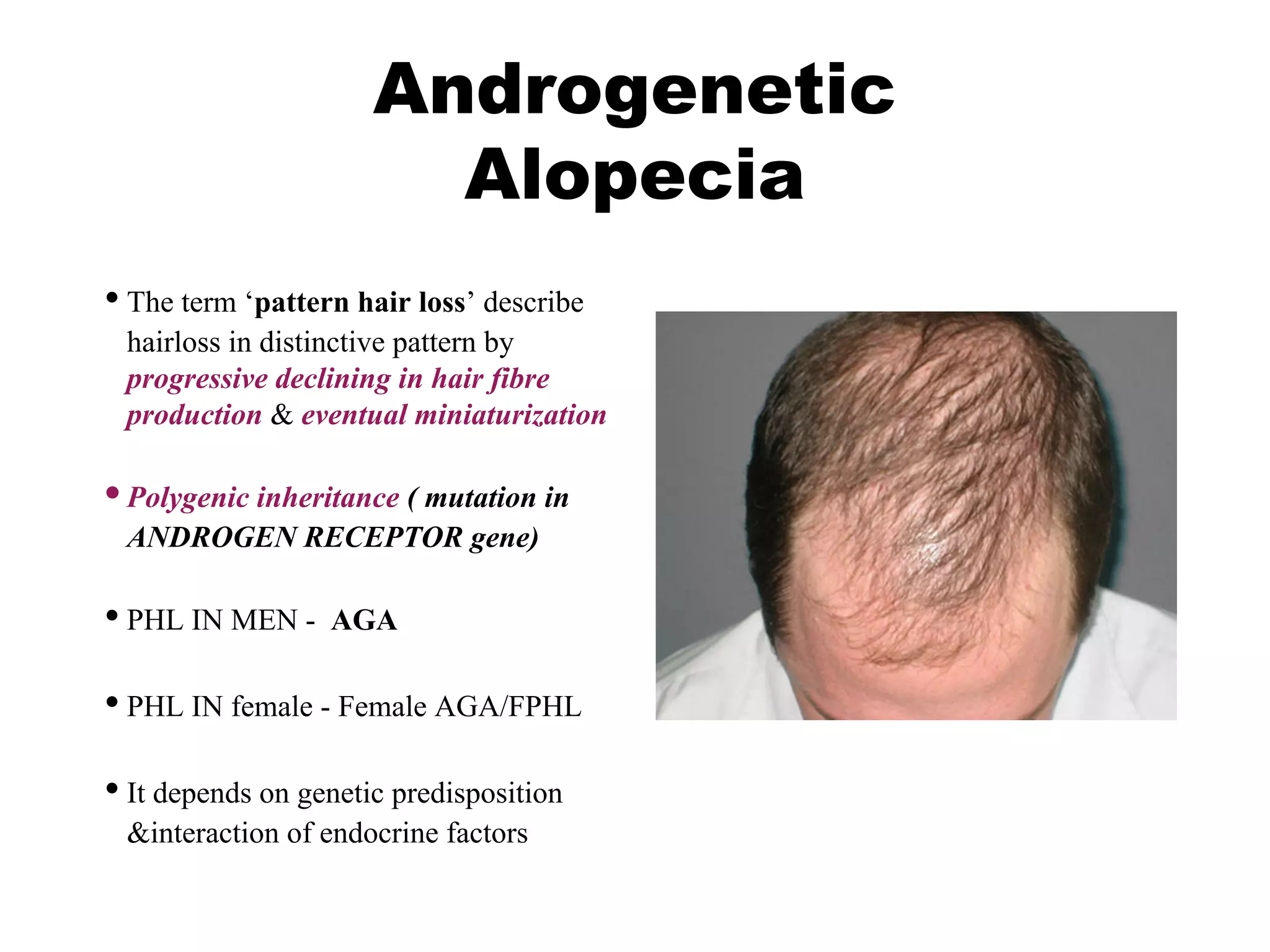Hair loss | PDF