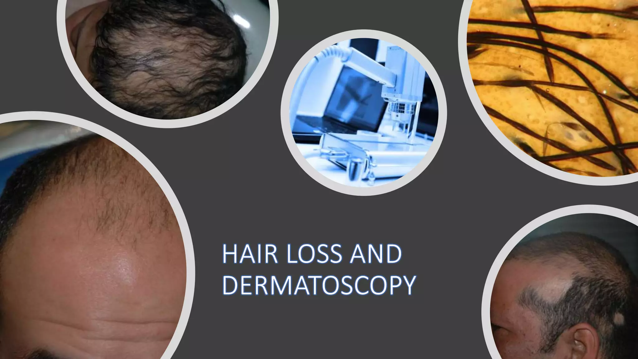 Hair Loss and Trichoscopy | PPTX