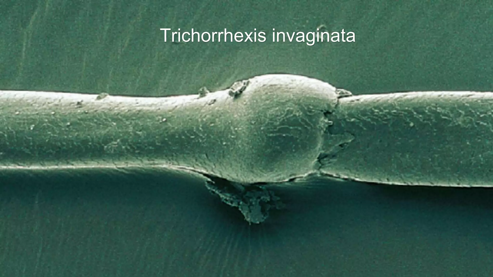 Hair Loss and Trichoscopy | PPTX