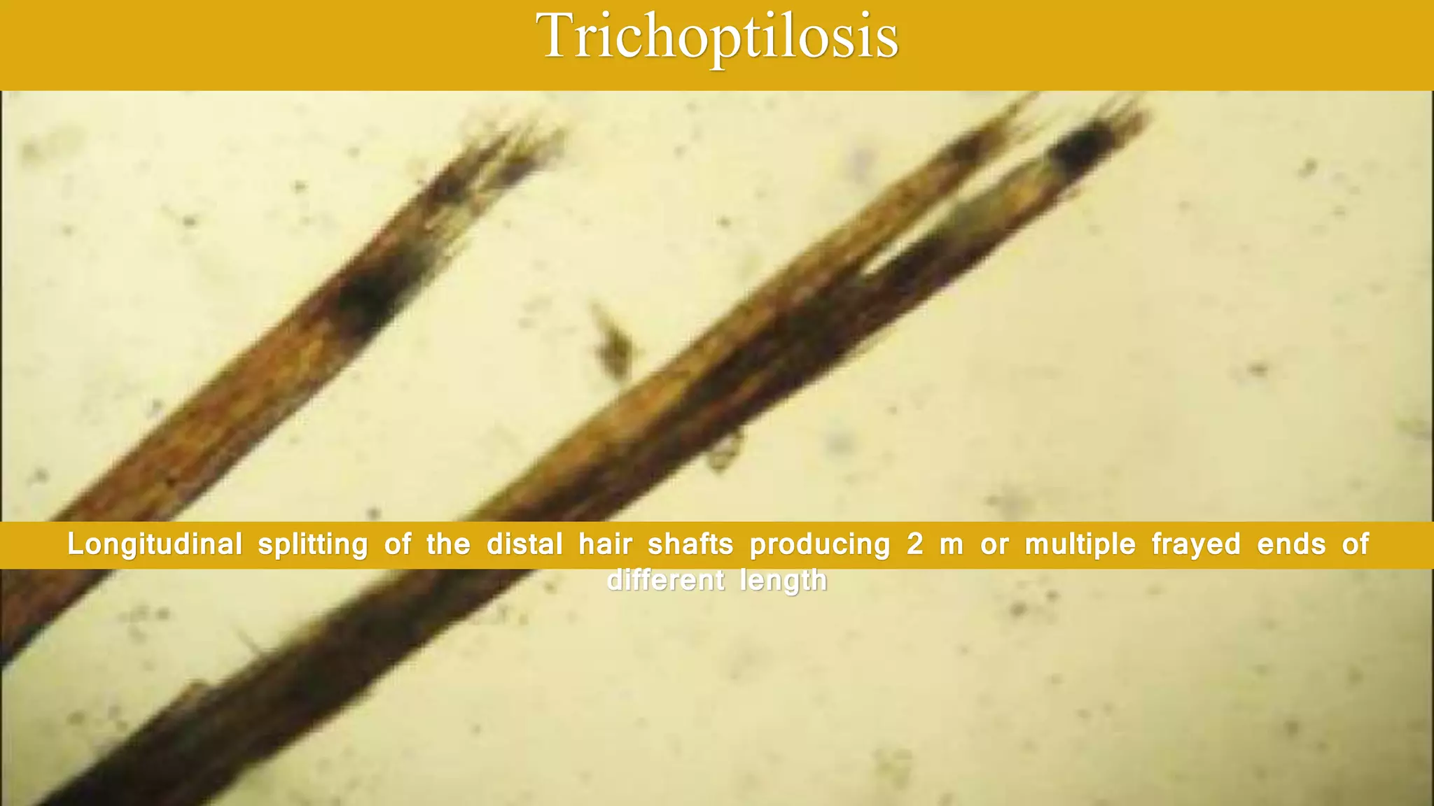 Hair Loss and Trichoscopy | PPTX