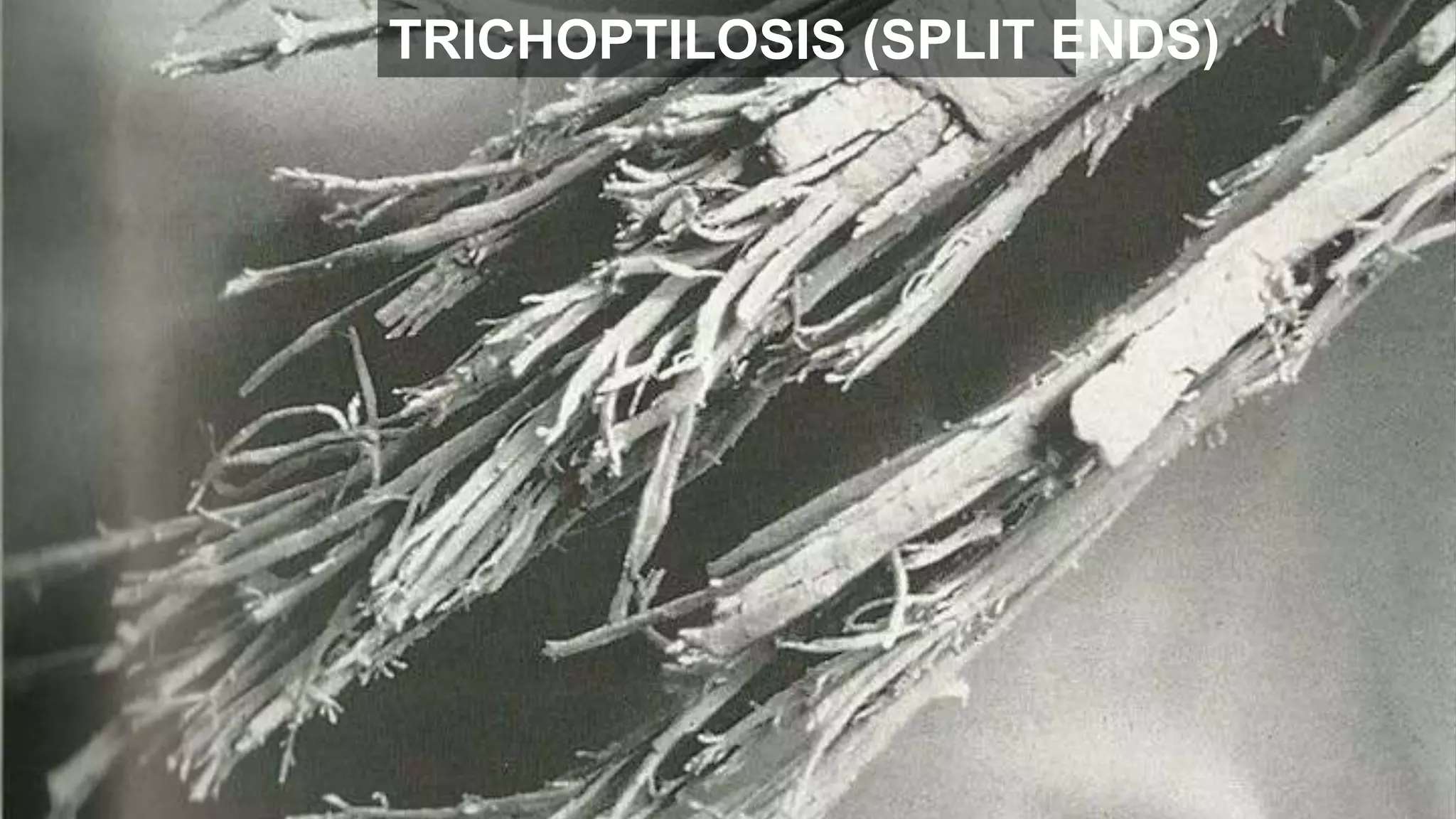 Hair Loss and Trichoscopy | PPTX