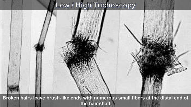 Hair Loss And Trichoscopy Ppt
