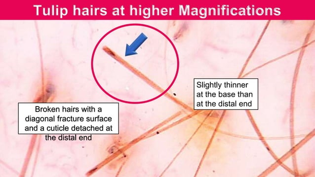 Hair Loss And Trichoscopy Ppt