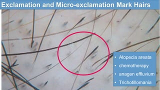 Hair Loss and Trichoscopy | PPTX