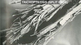 Hair Loss and Trichoscopy | PPTX