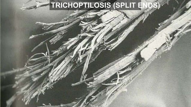Hair Loss And Trichoscopy Ppt