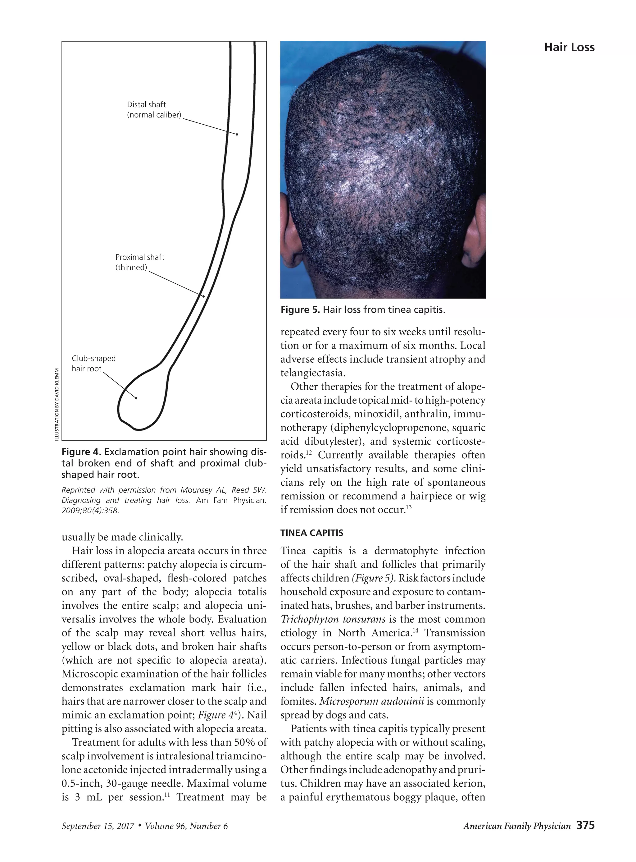 Hair loss common causes and treatment | PDF