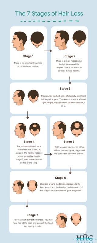 Hair loss Infographic.pdf
