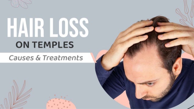 Hair Loss On Temples Causes And Treatments Ppt